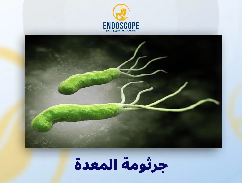جرثومة المعدة - EndoScope
